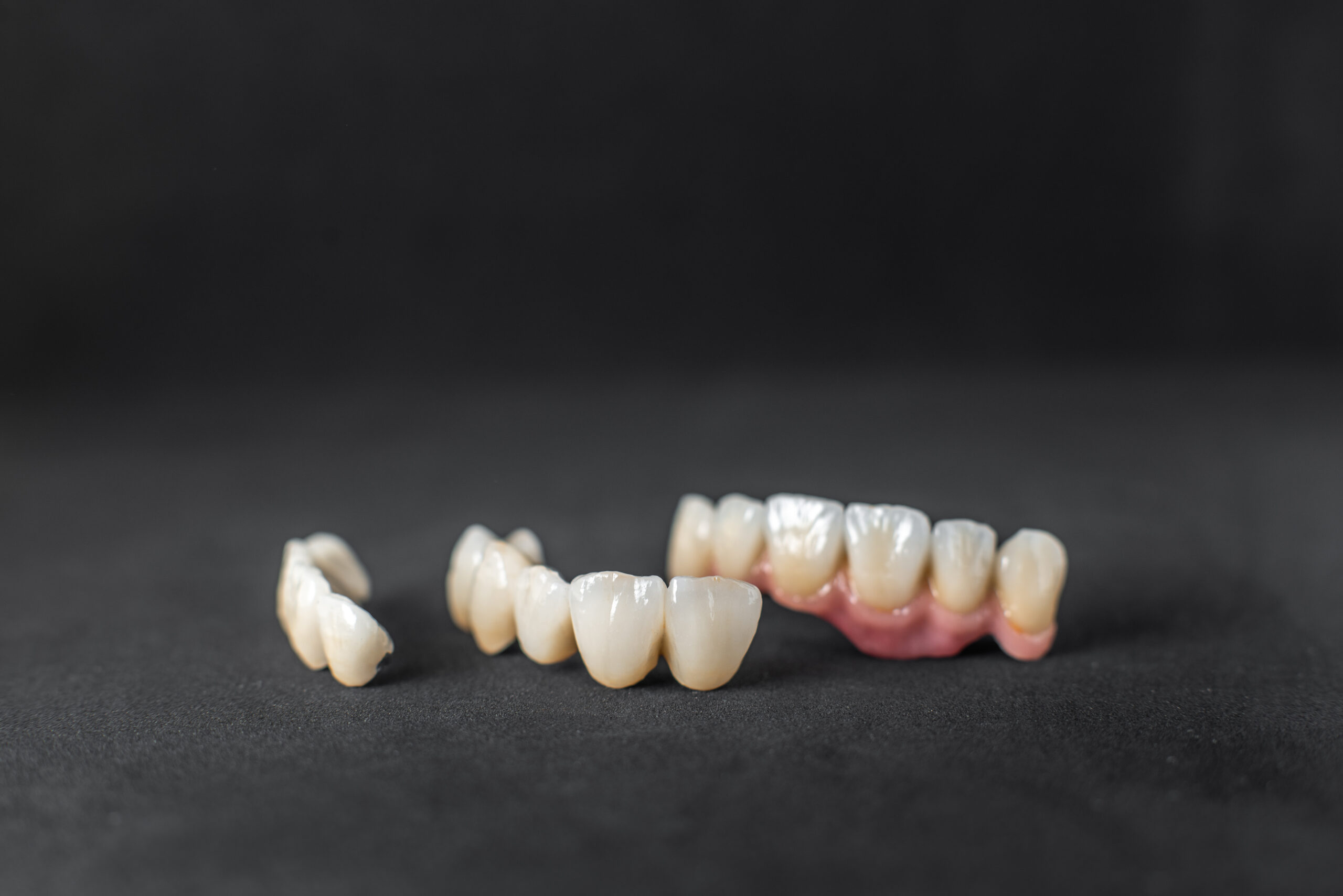 What You Need to Know About Dental Crowns